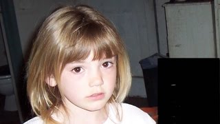 ハイランダー症候群は実在or嘘？sammyはかわいいが日本人の事例は？ - トレンドライフ